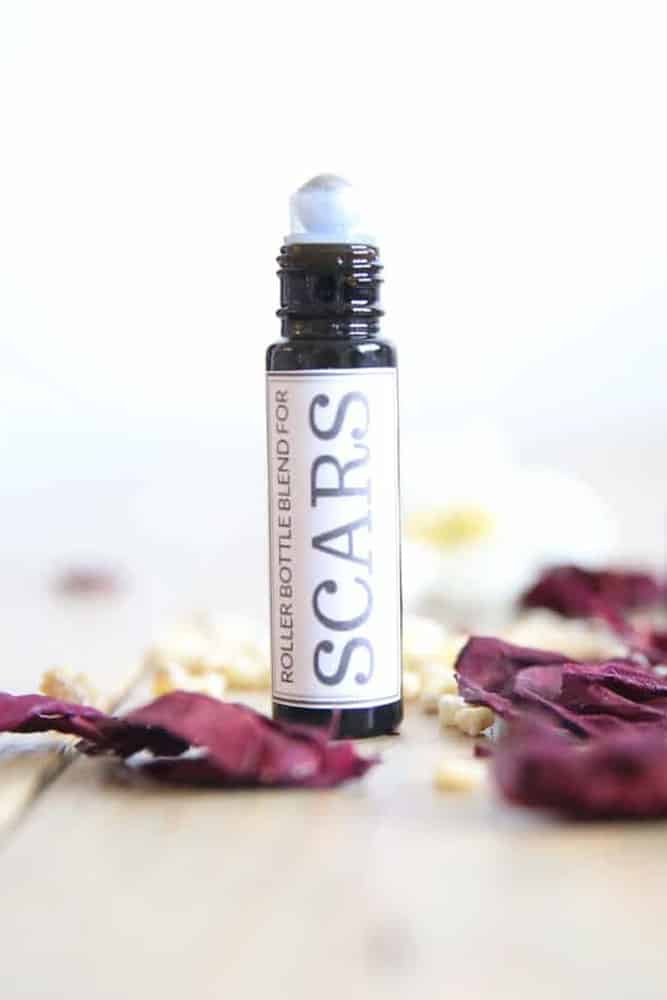Best Roller Bottle Blend for Scars - Our Oily House