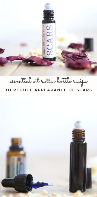 Best Roller Bottle Blend for Scars - Our Oily House